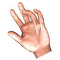 Hand & Finger Injuries Explained | Sportsinjuryclinic.net