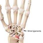 Wrist Pain & Injuries – What’s causing your wrist pain?