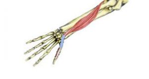 Wrist Bursitis - Symptoms, Causes, Treatment & Rehabilitation