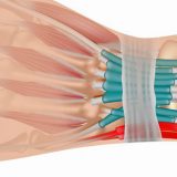 Wrist Bursitis - Symptoms, Causes, Treatment & Rehabilitation