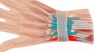 Wrist strain - Symptoms, Causes, Treatment & Rehabilitation