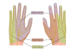 Cubital Tunnel Syndrome - Symptoms, Causes and Treatment