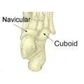 Cuboid Bone Sharp Pains