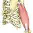Upper Arm Pain - Symptoms, Causes, Treatment & Rehabilitation