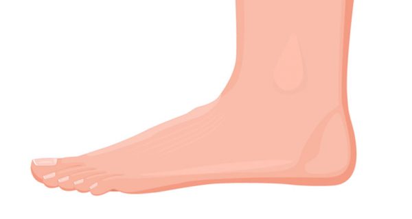 Midfoot Pain - Symptoms, Causes, Treatment and Rehabilitation