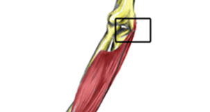 Skin Avulsion In Sports