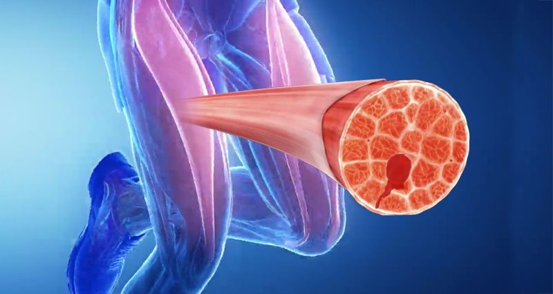 Thigh Contusion (Quadriceps Contusion) - Sportsinjuryclinic.net