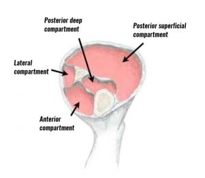 Posterior Compartment Syndrome - Symptoms, Causes & Treatment