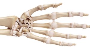 Volar plate injury - Symptoms, Causes & Treatment.