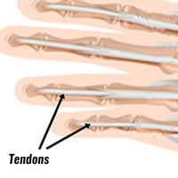 Hand & Finger Injuries - Sprains, Strains & Fractures Explained