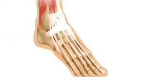 Pain On Top Of The Foot - Injuries, Causes, Treatment & Exercises