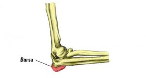 Dolor posterior del codo (espalda) - Sportsinjuryclinic.net | Reef Recovery