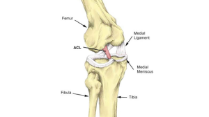 Lachman's Test - Sportsinjuryclinic.net